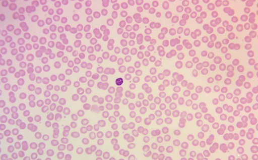 Automated classification of White Blood Cells (WBCs) with Deep Learning